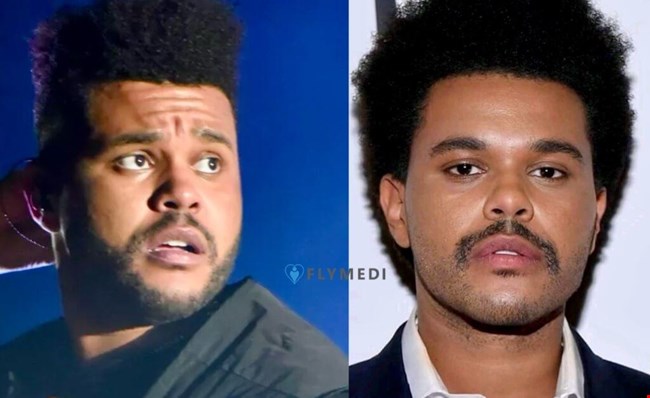 The Weeknd's Aesthetic Evolution: Exploring Nose, Jaw, and F